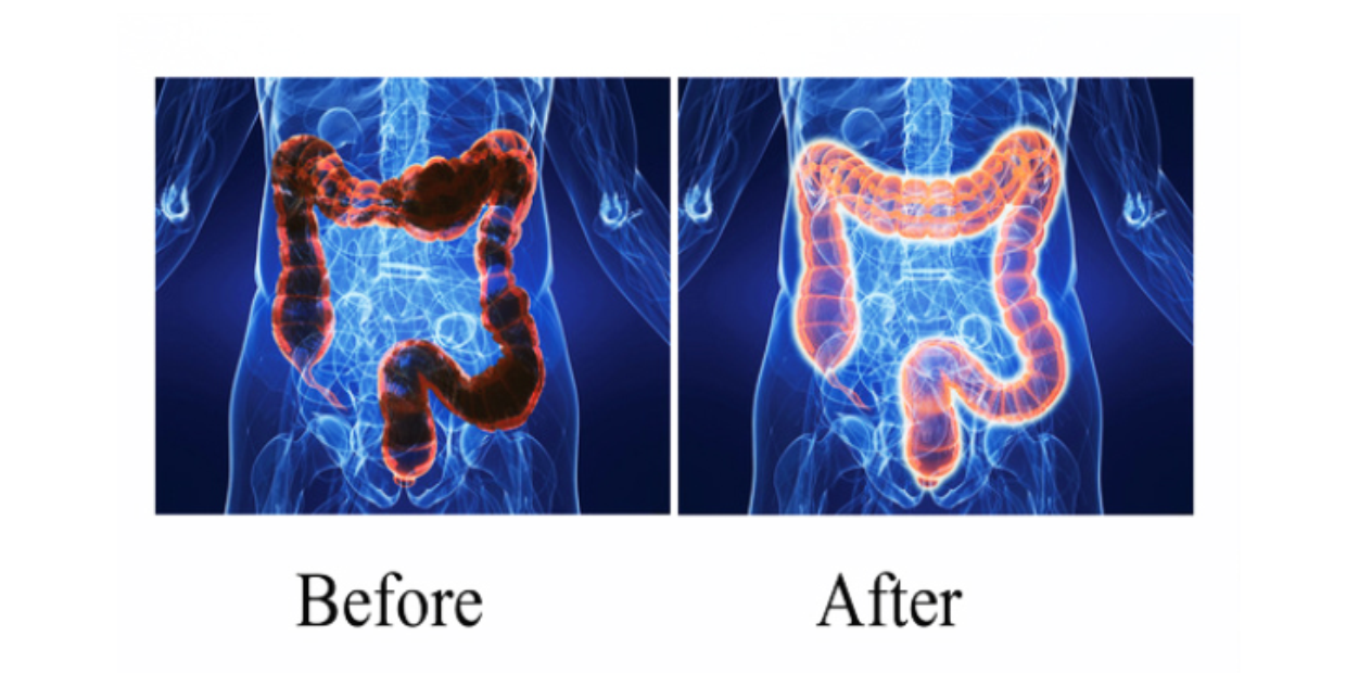 Colonic Irrigation Clinics in Brisbane | Colon Cleanse Near Me